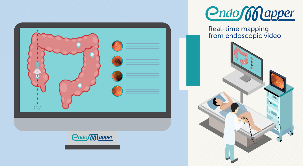 EndoMapper | Juan José Gómez